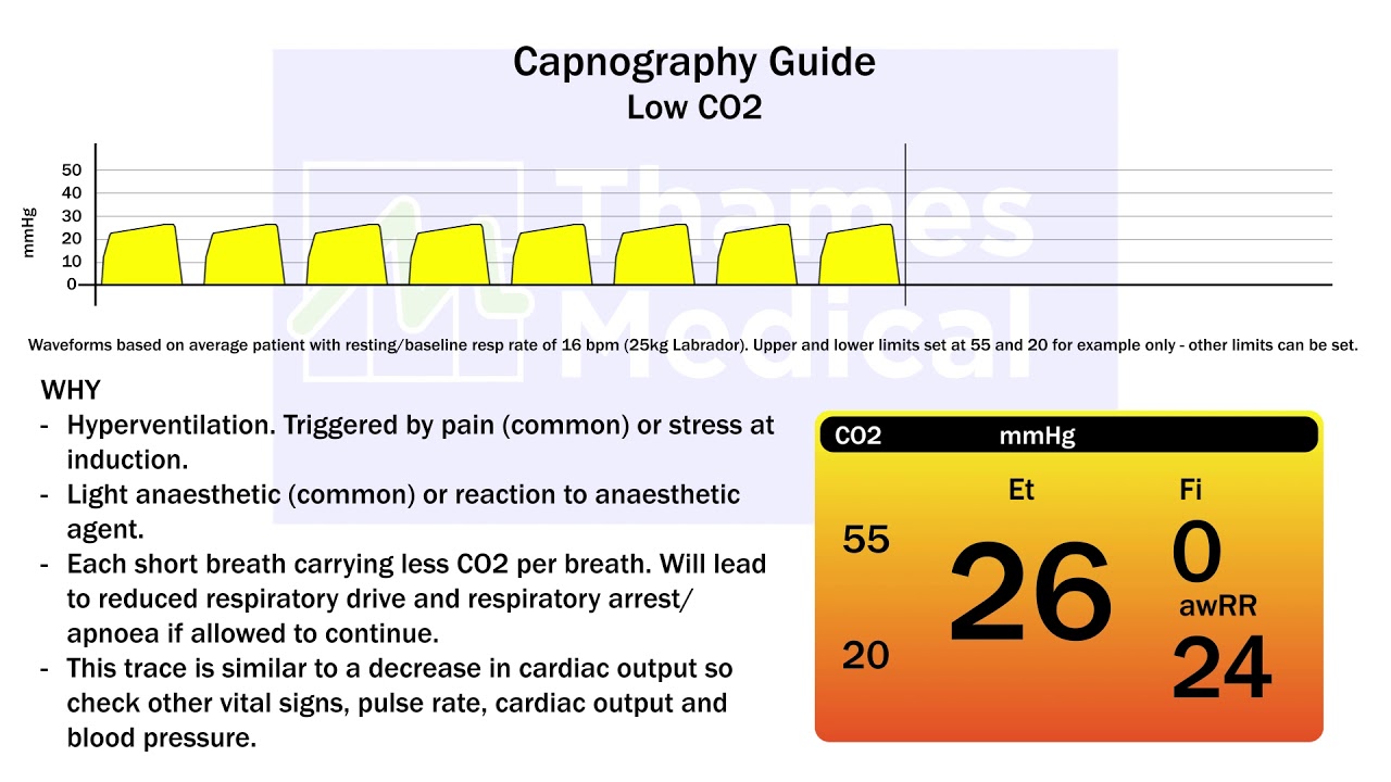 Capnography Waveform Library - Thames Medical Ltd.